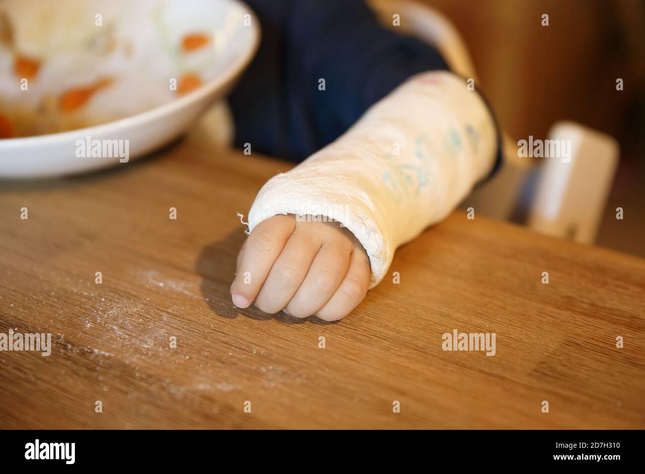 Broken Wrist High Resolution Stock Photography and Images - Alamy