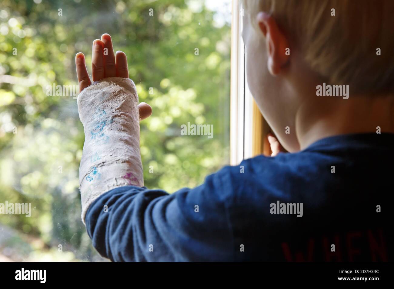 Plaster cast boy hi-res stock photography and images - Alamy