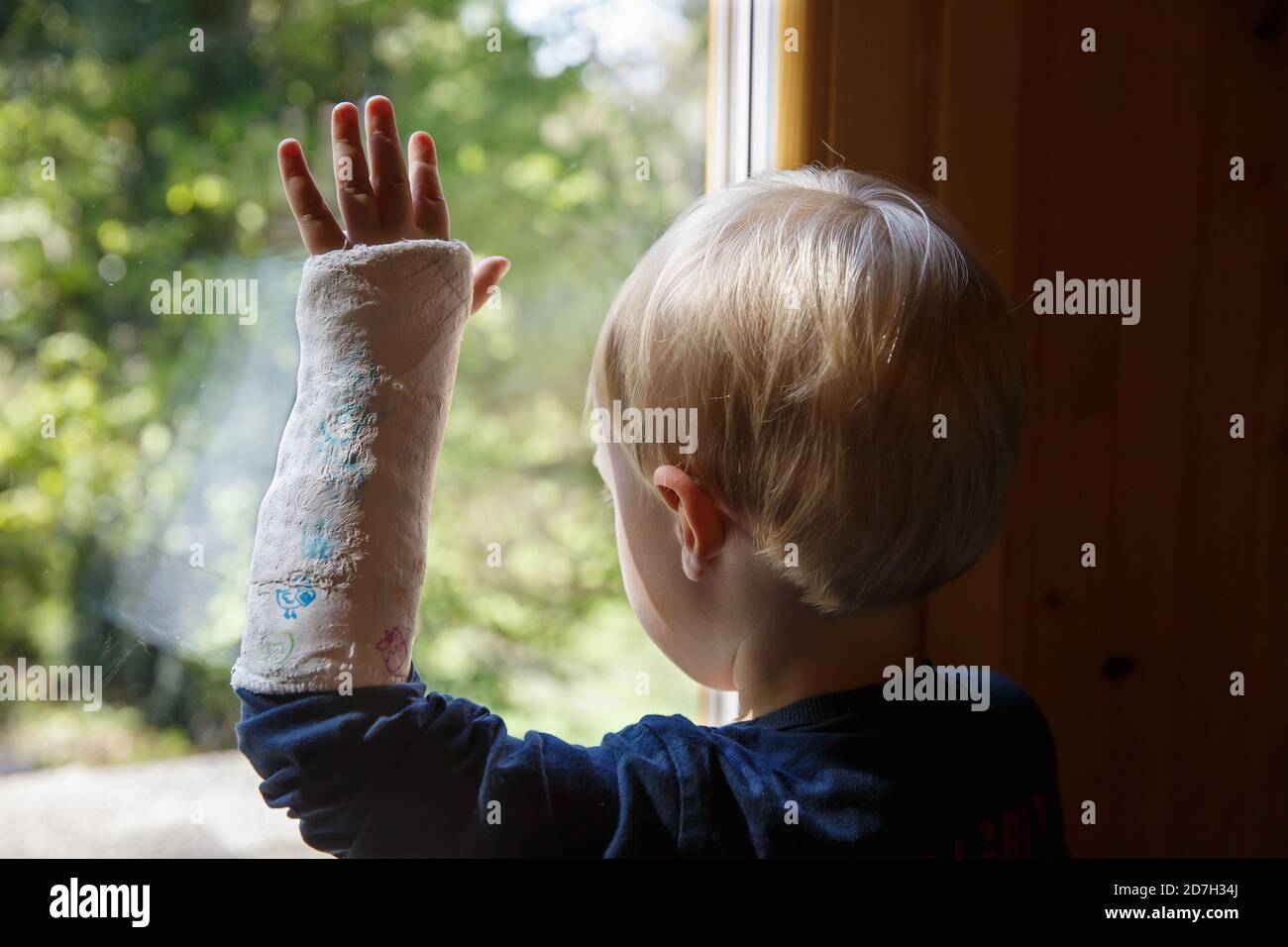 Plaster cast boy hi-res stock photography and images - Alamy