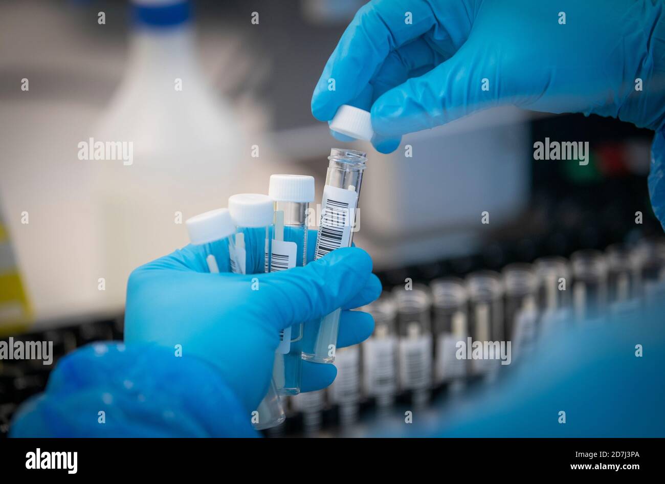 Patient samples are transferred by scientists into plates before ...