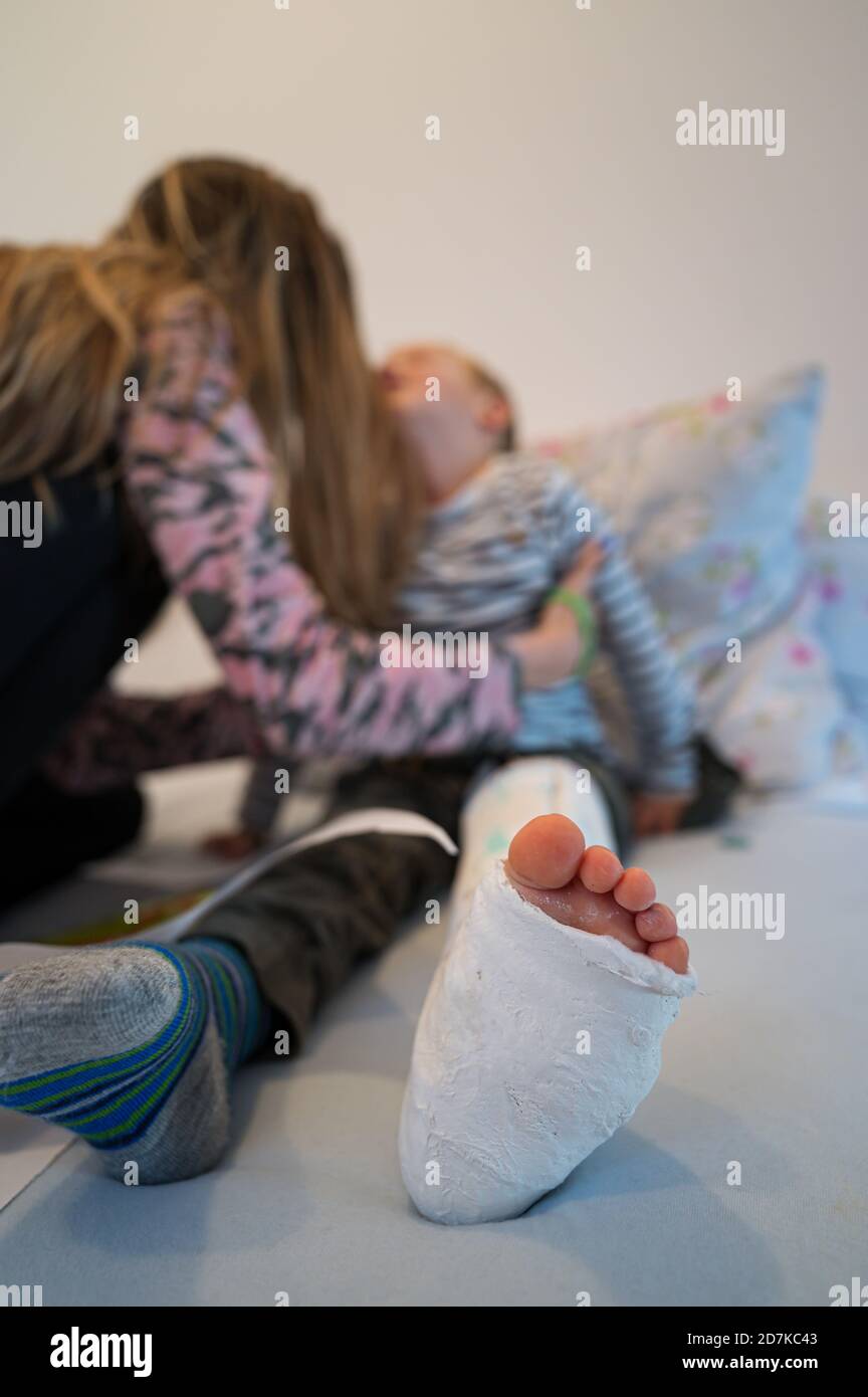 Mother placing her toddler child with a broken injured leg in a cast on ...
