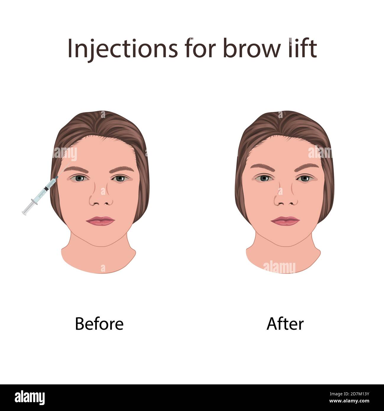 Woman before after face lift hi-res stock photography and images - Alamy