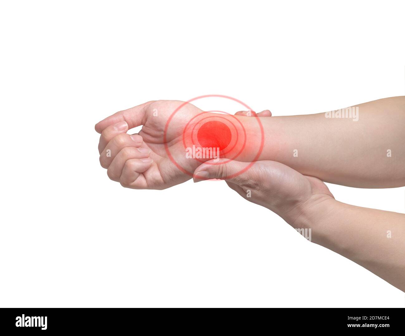 X ray broken bone hi-res stock photography and images - Alamy