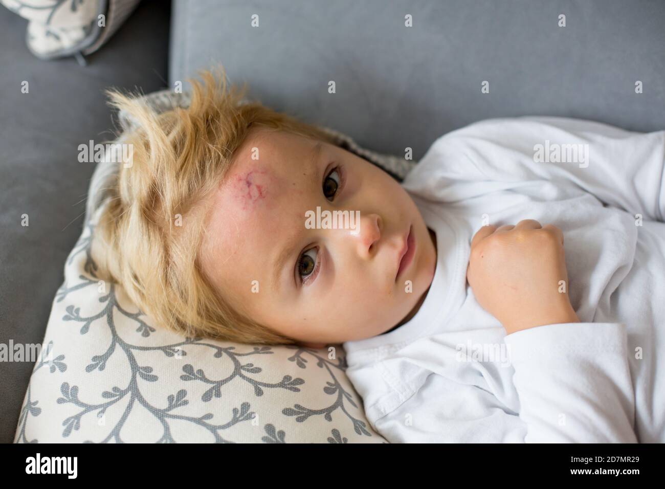 Toddler boy, lying on the couch at home with big bump on the forehead ...