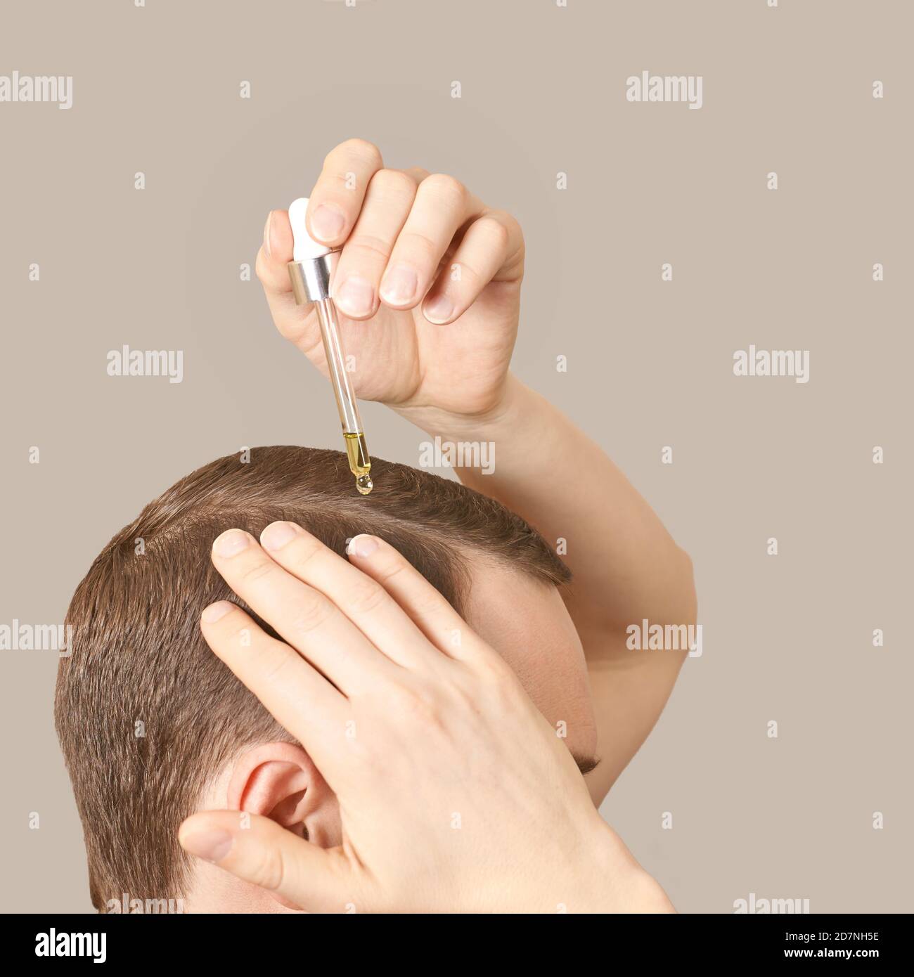 Man baldness treatment. Nature hair care Stock Photo - Alamy