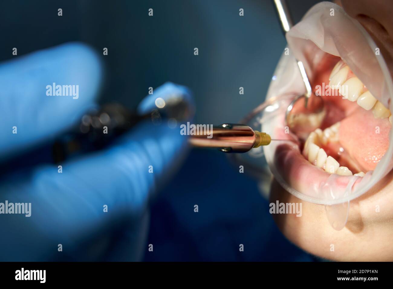 Dentist making local anesthesia shot before surgery. Patient visiting a ...