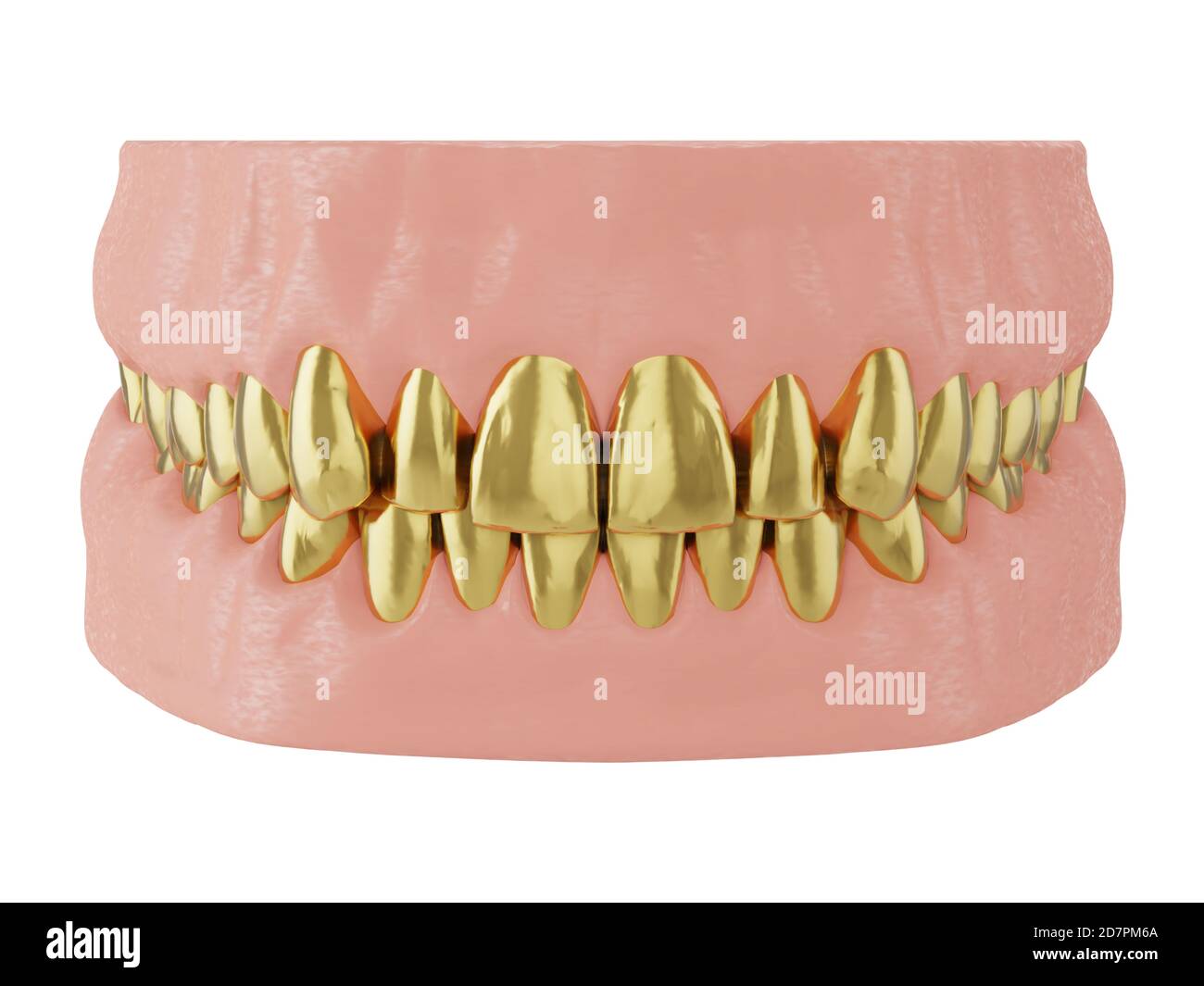 metal golden teeth in the jaw, golden crown of a teeth, 3d render Stock ...