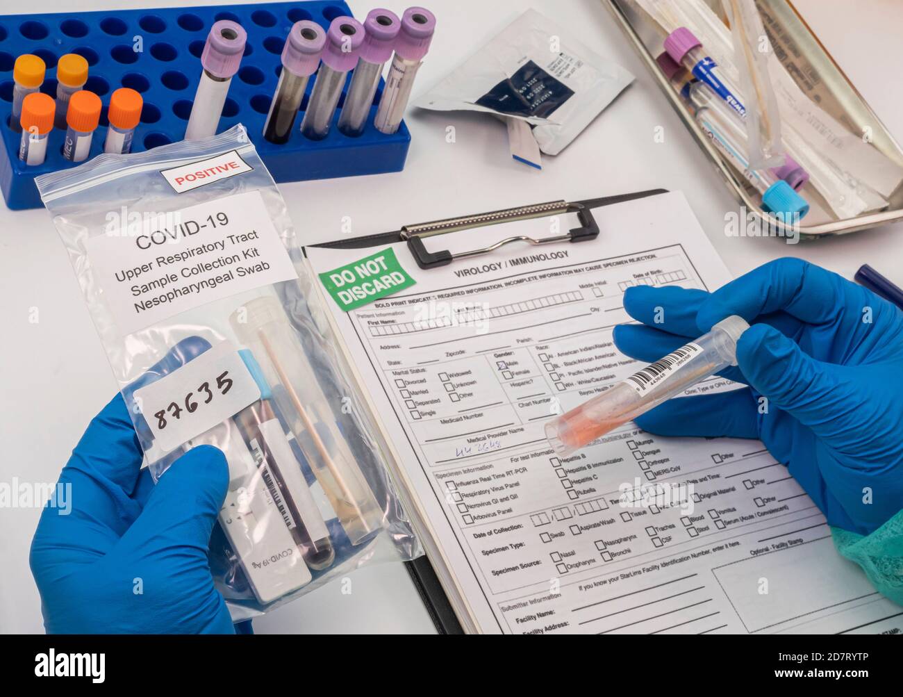 Nurse analyses positive PCR tests of covid-19 in a hospital laboratory ...
