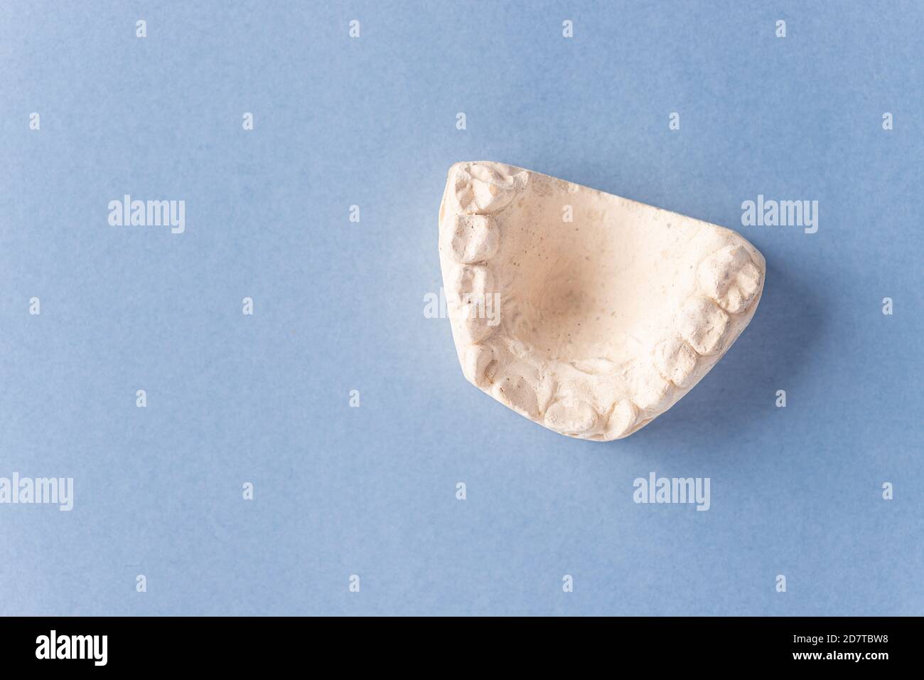 plaster cast of child's jaw on blue background Stock Photo - Alamy