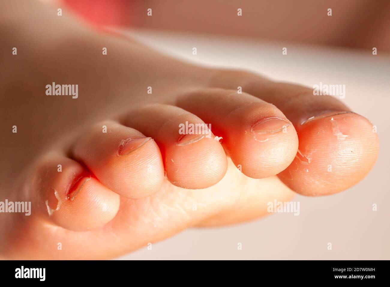 The girl's right foot cloth up bwtween the toes Stock Photo - Alamy