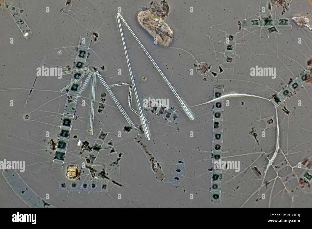 Marine Phytoplankton, Bacteriastrum, Naples, MID 1800's, unpolluted ...