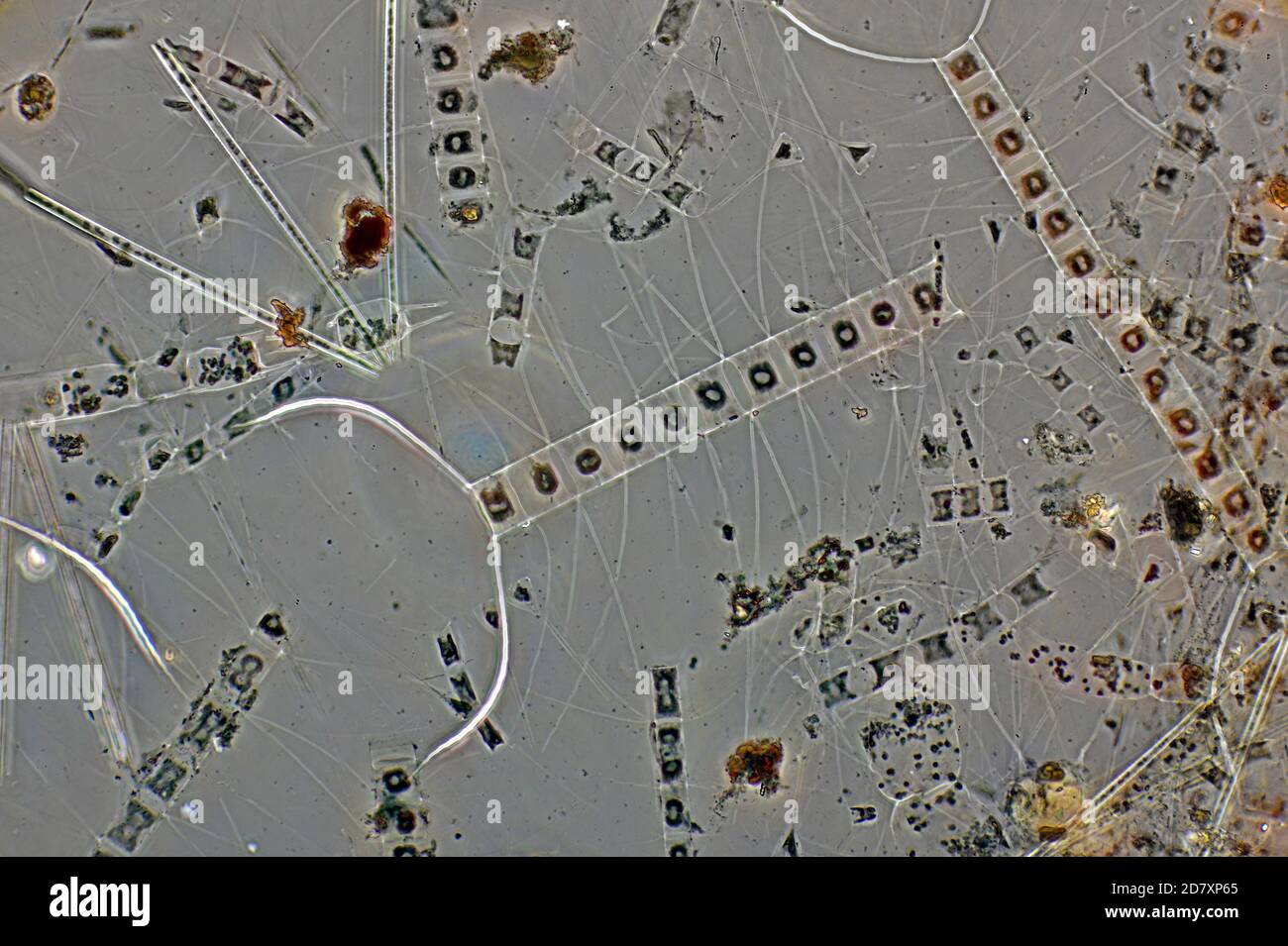 Marine Phytoplankton, Bacteriastrum, Naples, MID 1800's, unpolluted ...