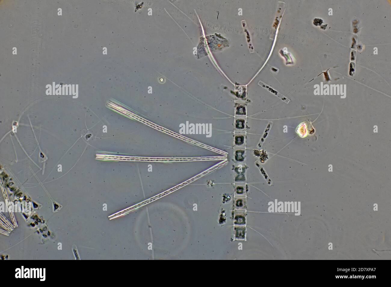 Marine Phytoplankton, Bacteriastrum, Naples, MID 1800's, unpolluted ...