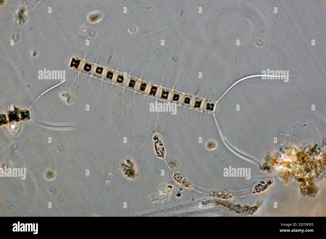 Marine Phytoplankton, Bacteriastrum, Naples, MID 1800's, unpolluted ...