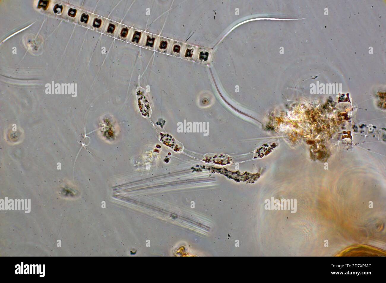 Marine Phytoplankton, Bacteriastrum, Naples, MID 1800's, unpolluted ...