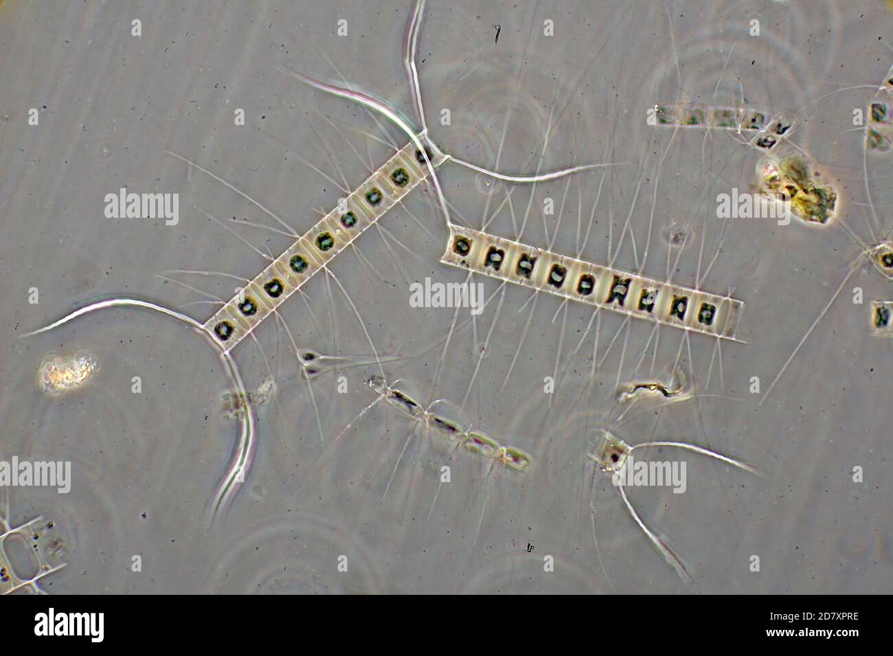 Marine Phytoplankton, Bacteriastrum, Naples, MID 1800's, unpolluted ...