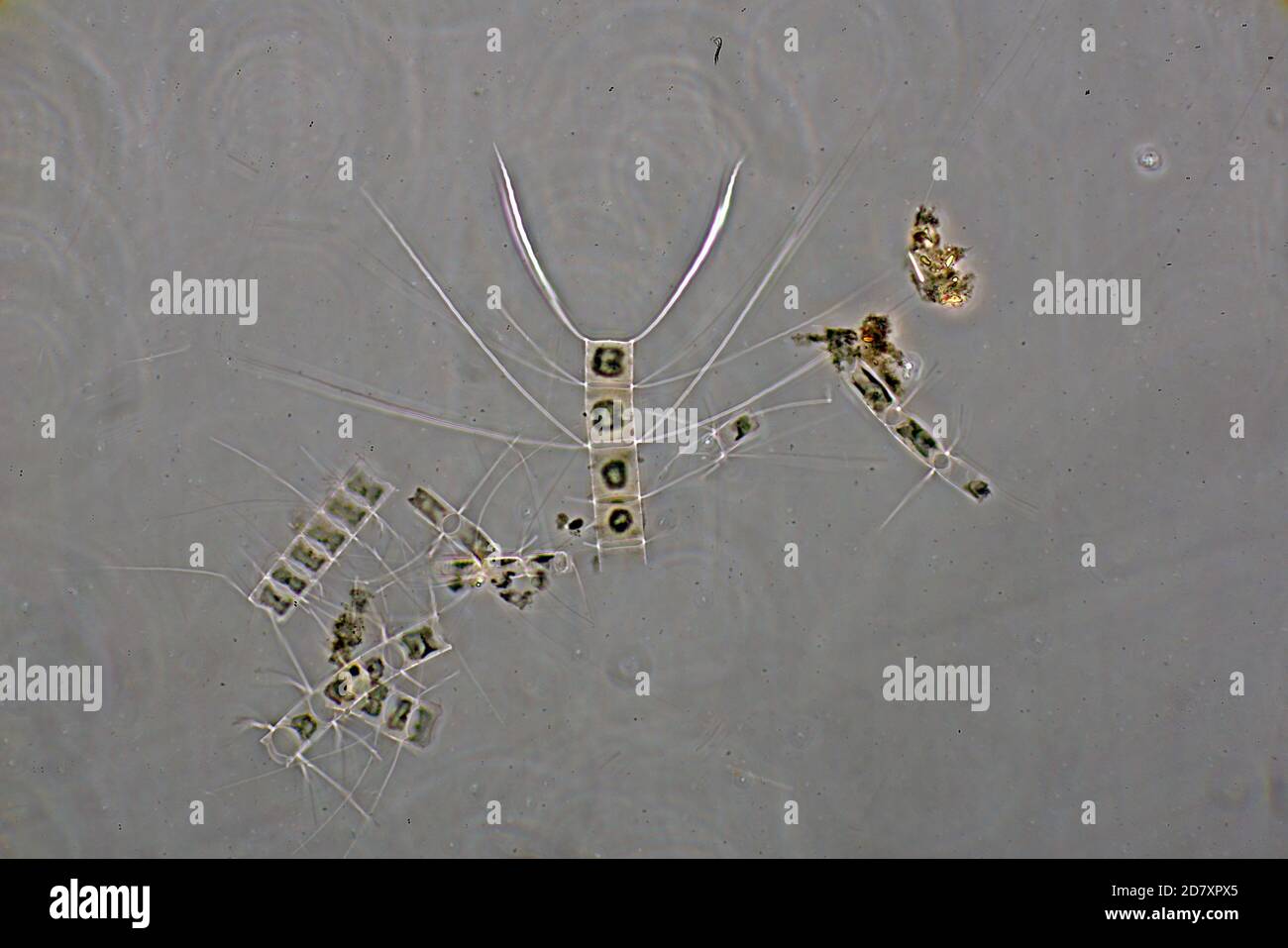 Marine Phytoplankton, Bacteriastrum, Naples, MID 1800's, unpolluted ...