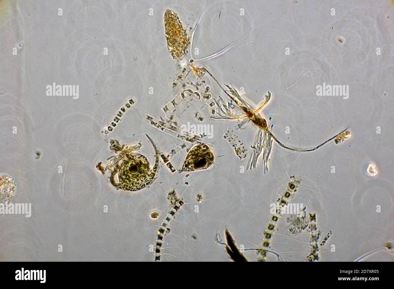 Marine Phytoplankton, Bacteriastrum, Naples, MID 1800's, unpolluted ...