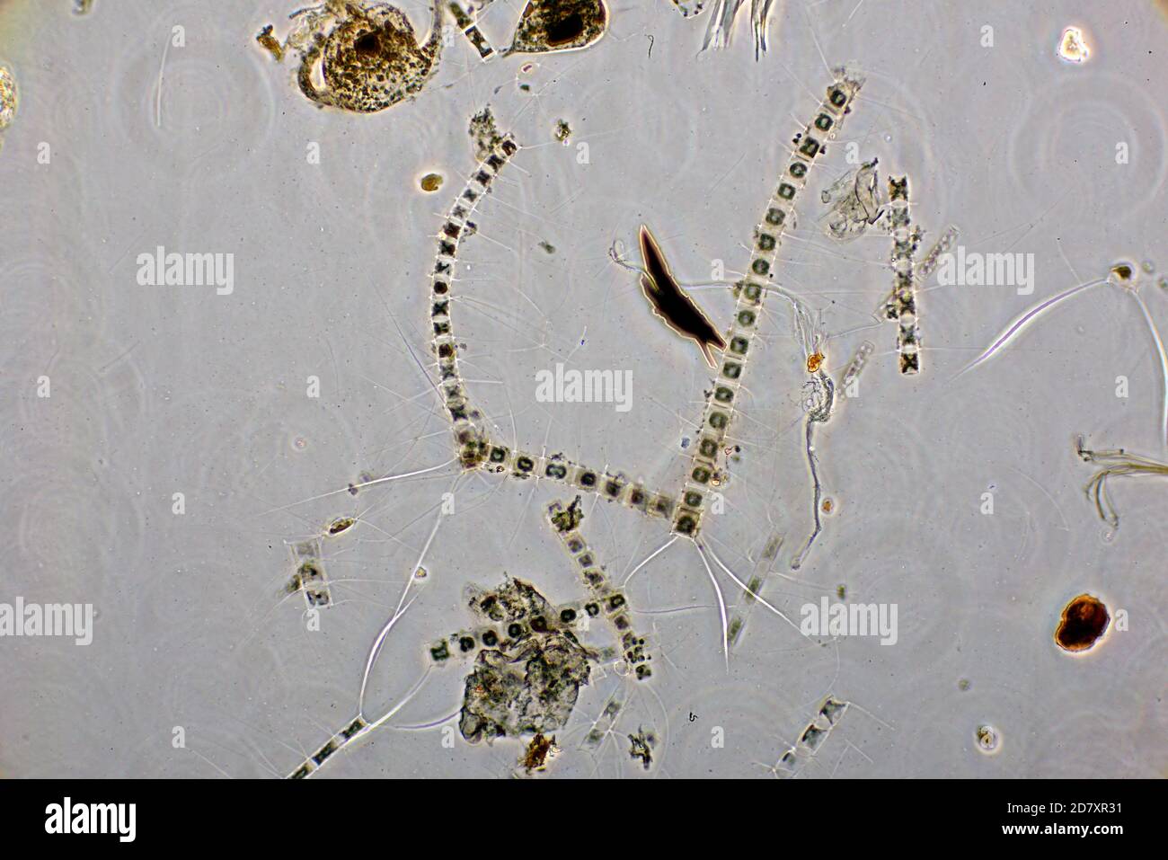 Marine Phytoplankton, Bacteriastrum, Naples, MID 1800's, unpolluted ...