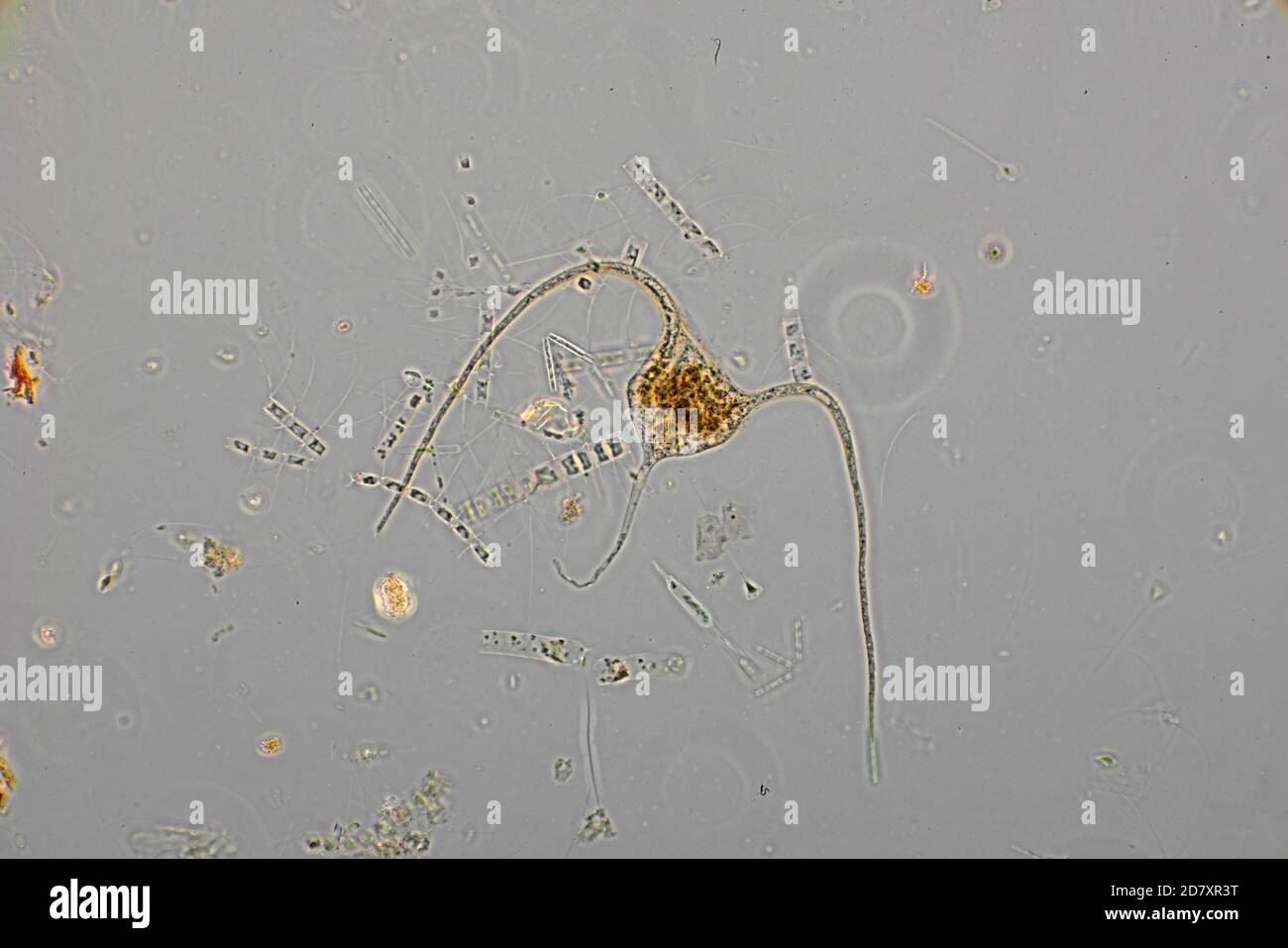 Marine Phytoplankton, Bacteriastrum, Naples, MID 1800's, unpolluted ...