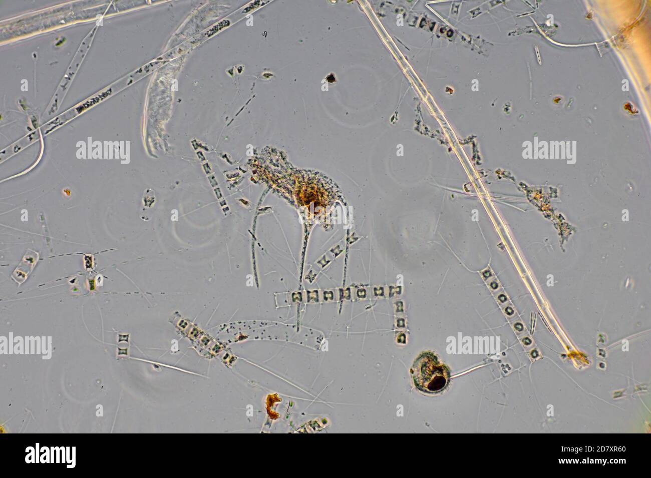 Ceratium tripos tripos muelleri bory de saint vinvent 1826 hi-res stock ...
