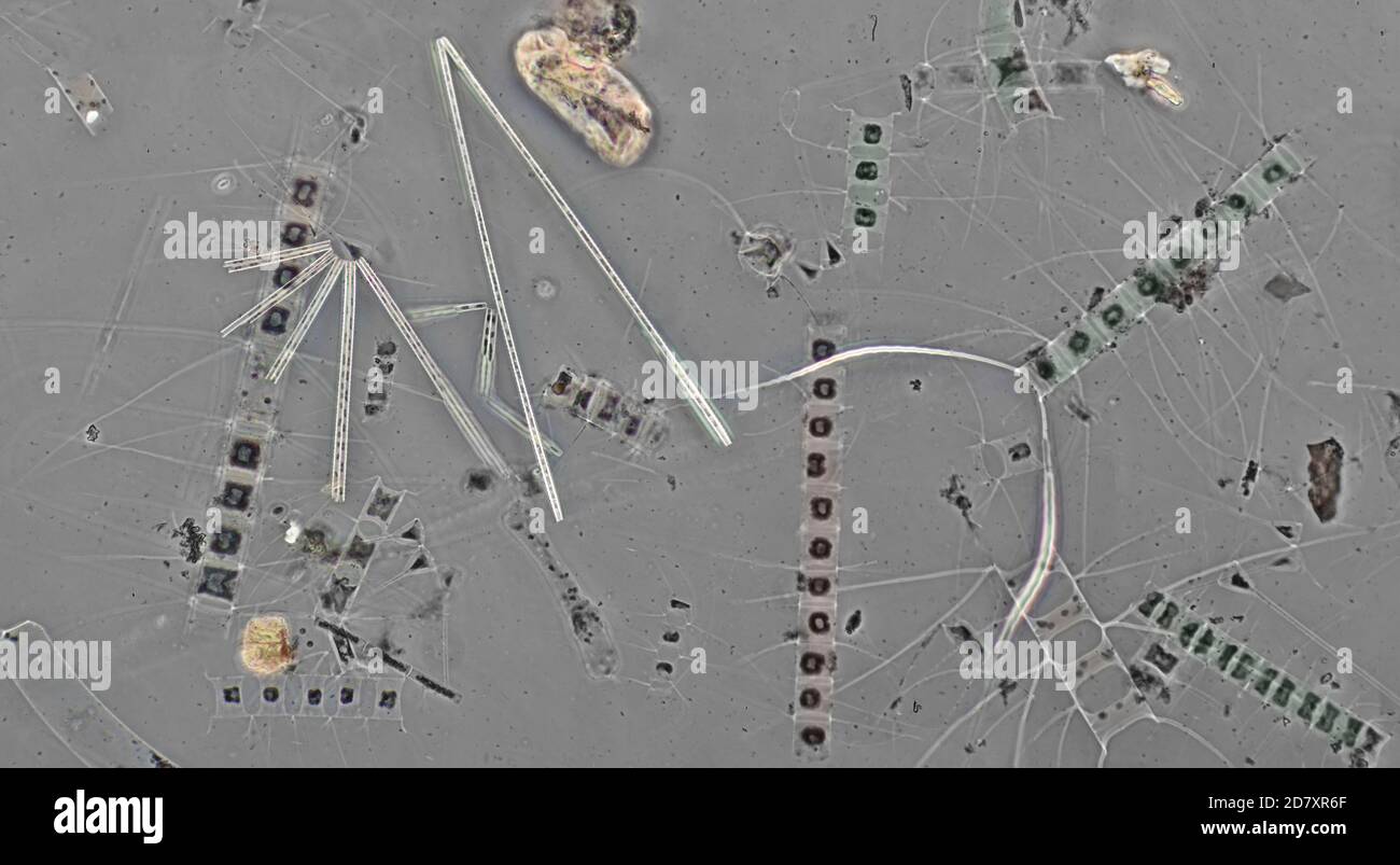 Marine Phytoplankton, Bacteriastrum, Naples, MID 1800's, unpolluted ...