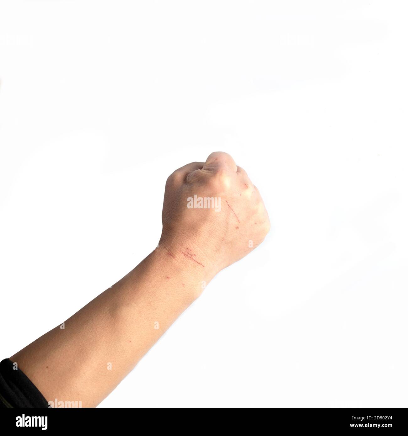 Scars arm hi-res stock photography and images - Alamy