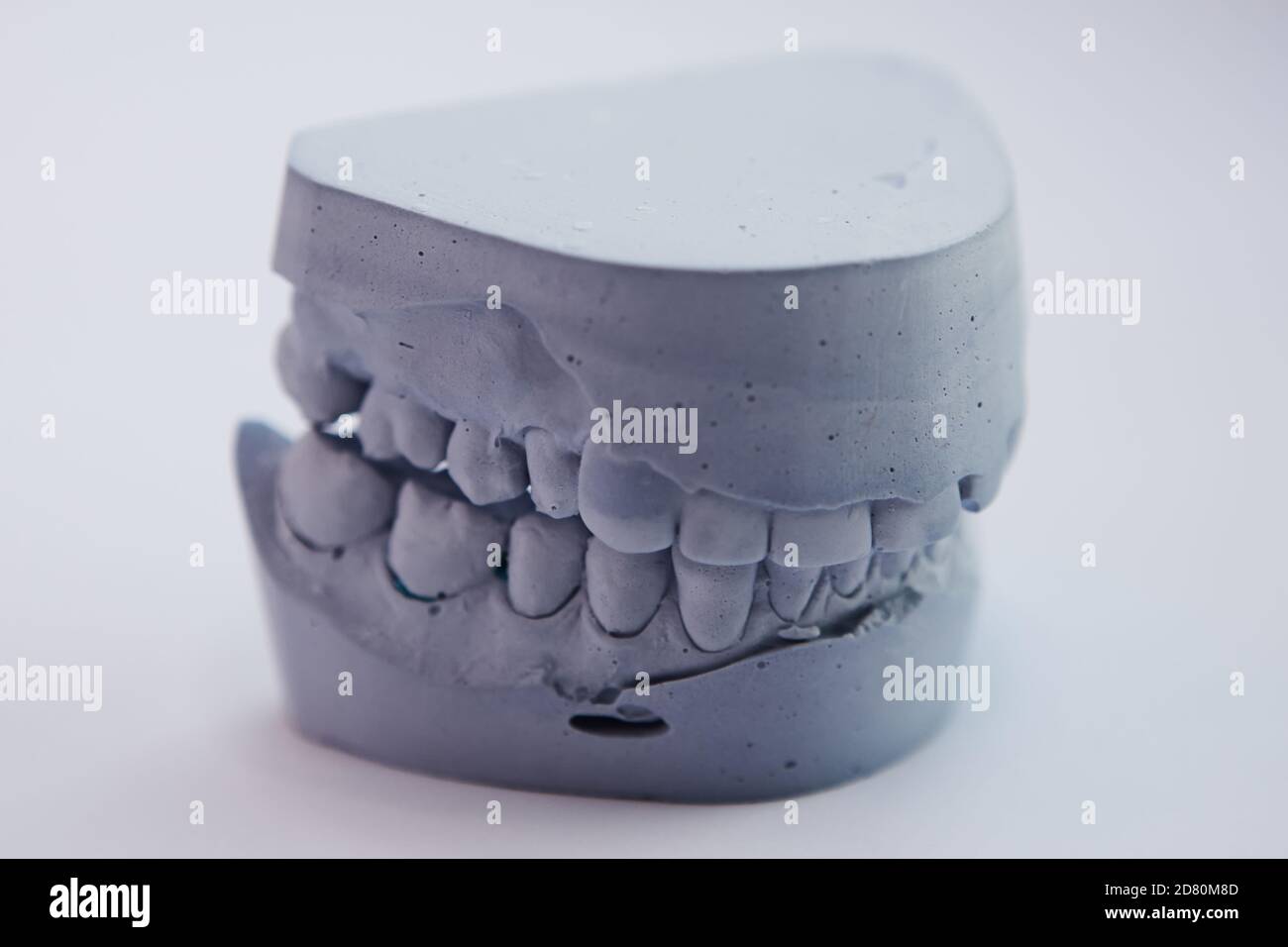 Dental Casting Plaster at Neomi Ingram blog