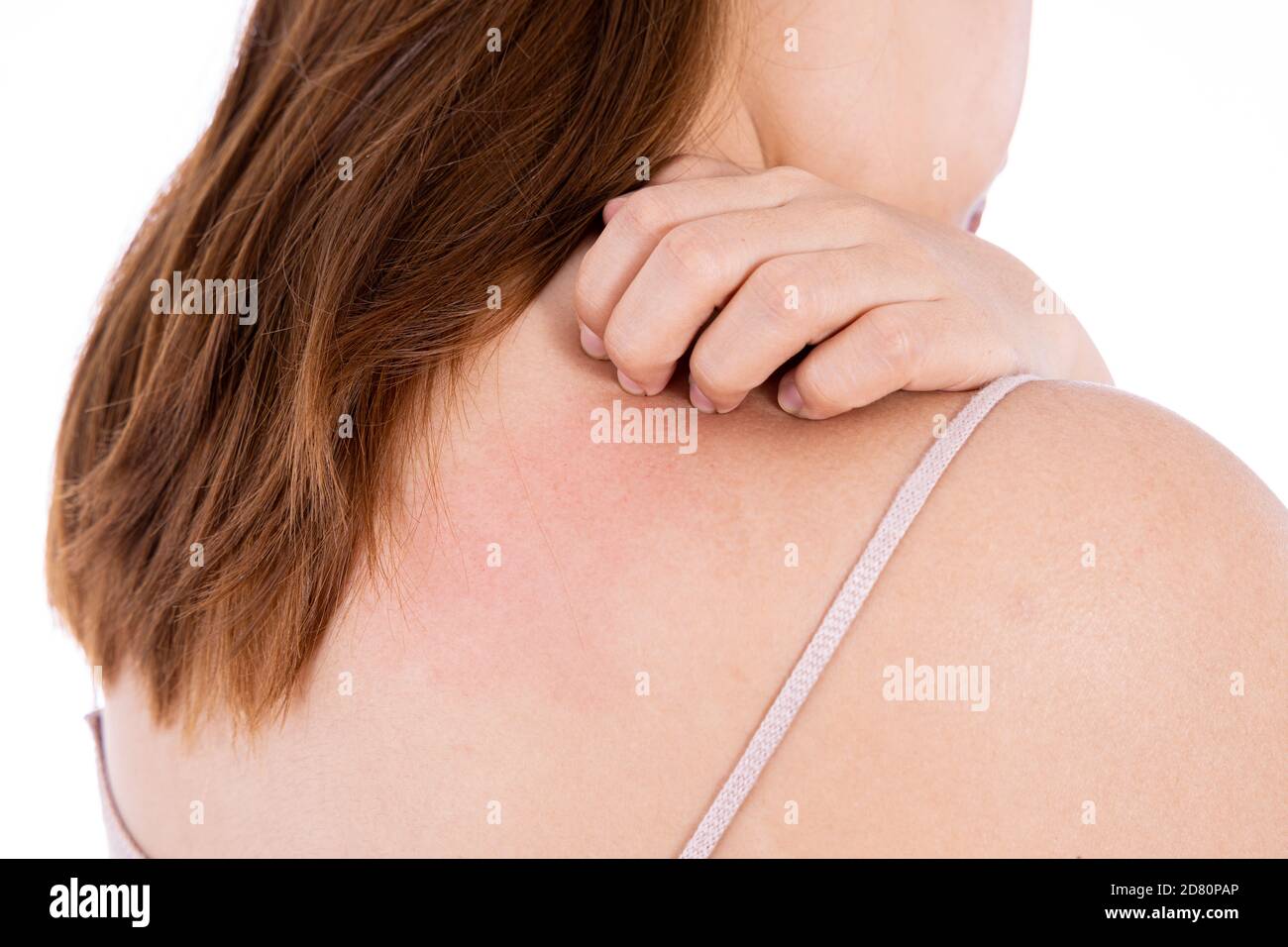 Female scratching her back isolated white background. Medical ...