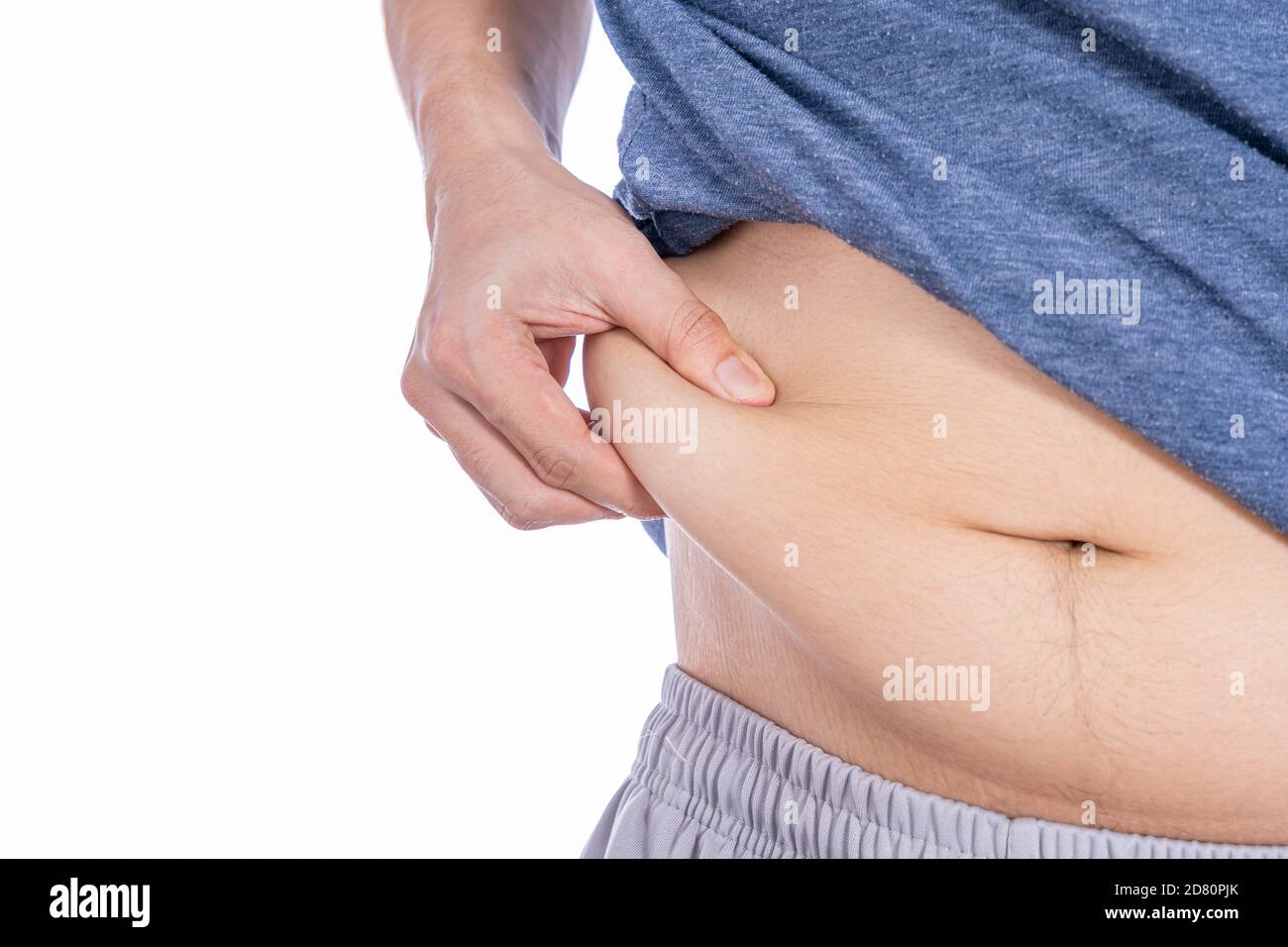 Fat man holding excessive fat belly, overweight fatty belly isolated ...