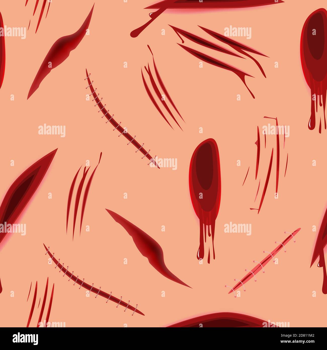 Lacerations wounds Stock Vector Images - Alamy