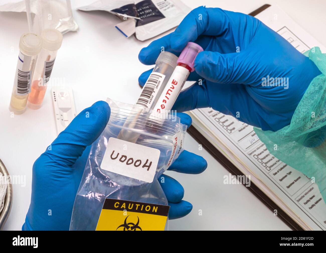 Nurse analyses positive PCR tests of covid-19 in a hospital laboratory ...