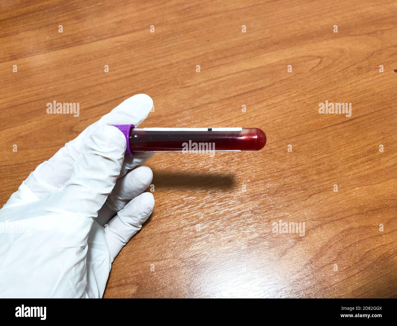 Covid-19 coronavirus disease blood test tube in hands Stock Photo - Alamy