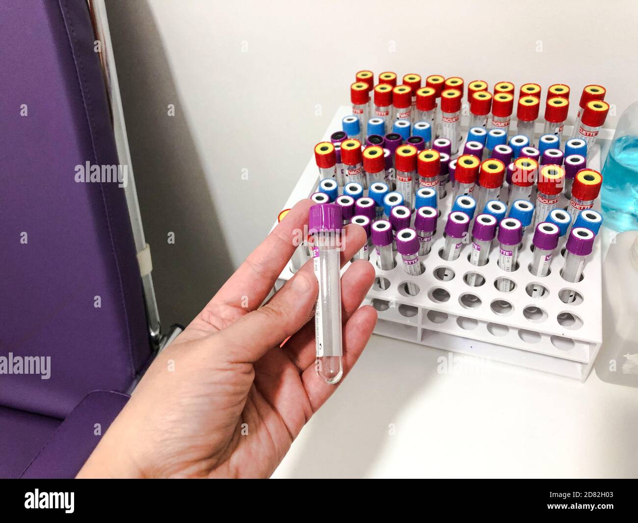 Test tube plasma in hands hi-res stock photography and images - Alamy