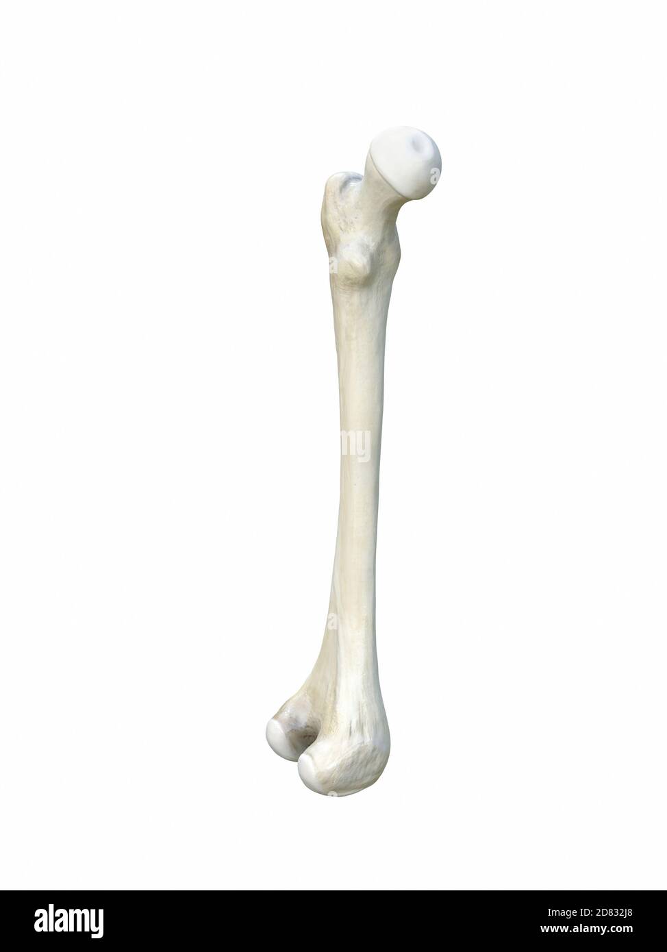 Broken femur x ray Cut Out Stock Images & Pictures - Alamy