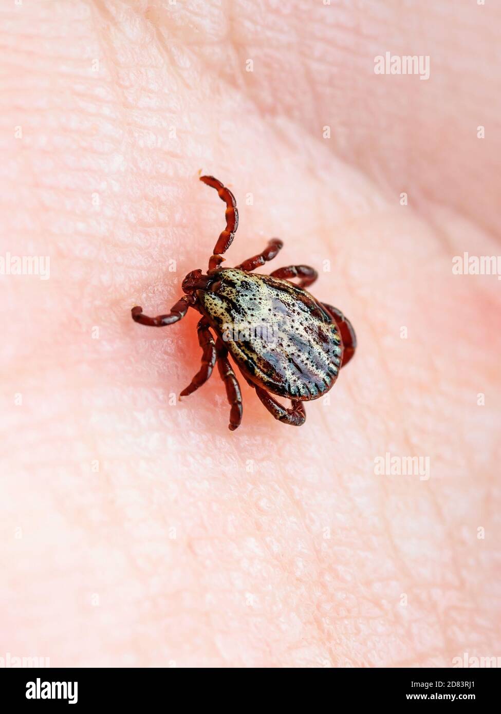 Insect Bite Skin High Resolution Stock Photography and Images - Alamy