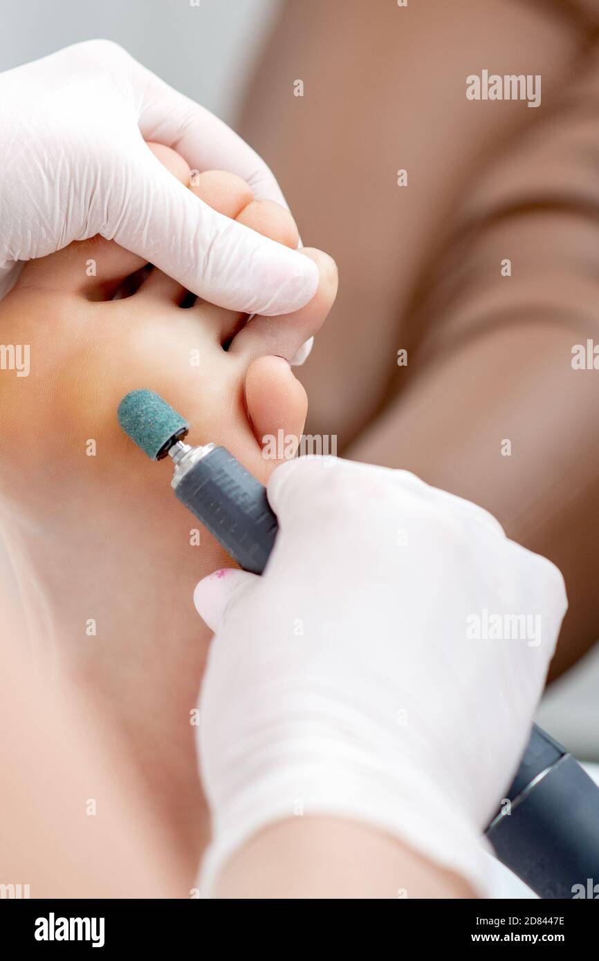 Peeling feet pedicure procedure from callus on foot by hands of ...