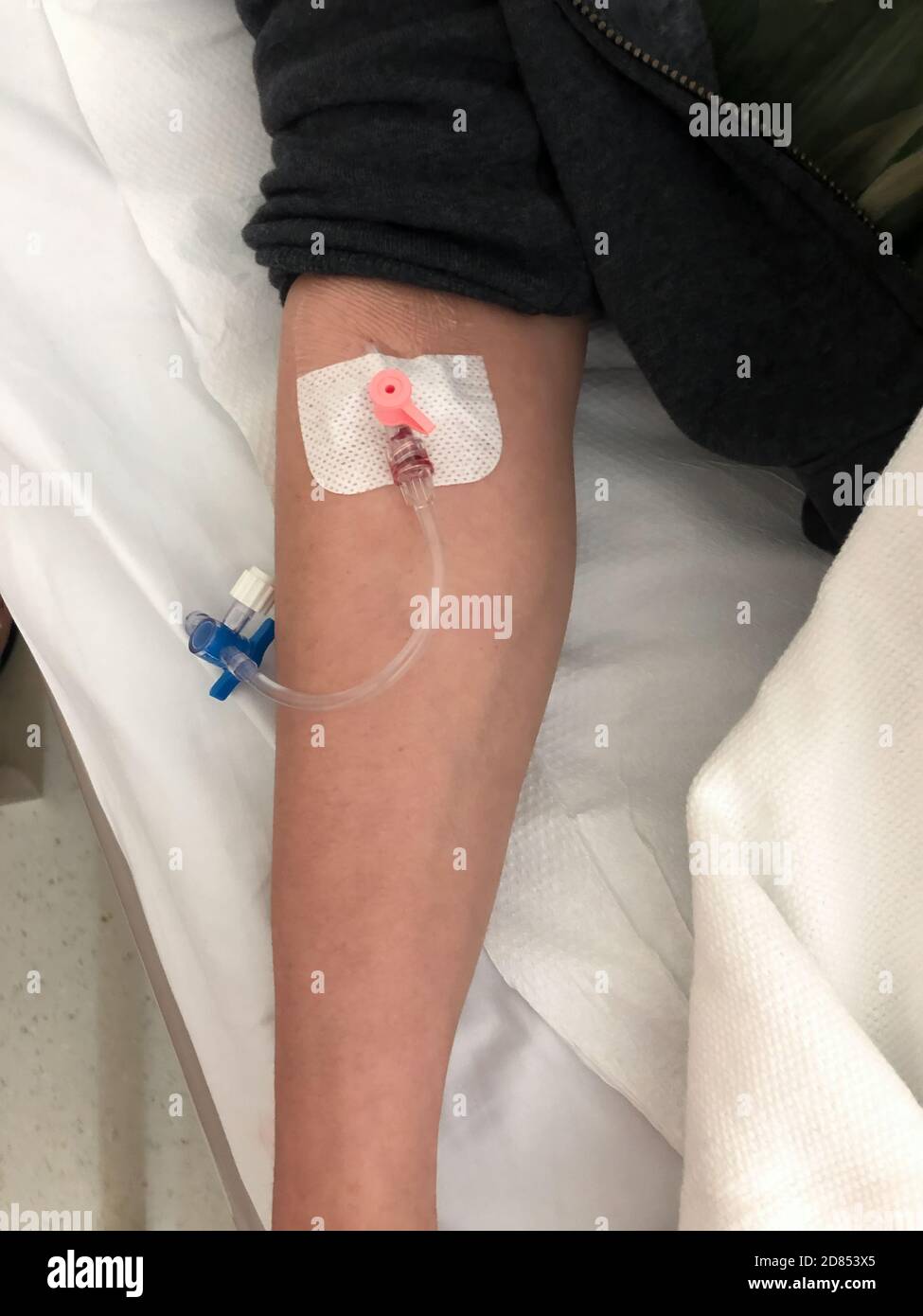 Iv cannula hi-res stock photography and images - Alamy