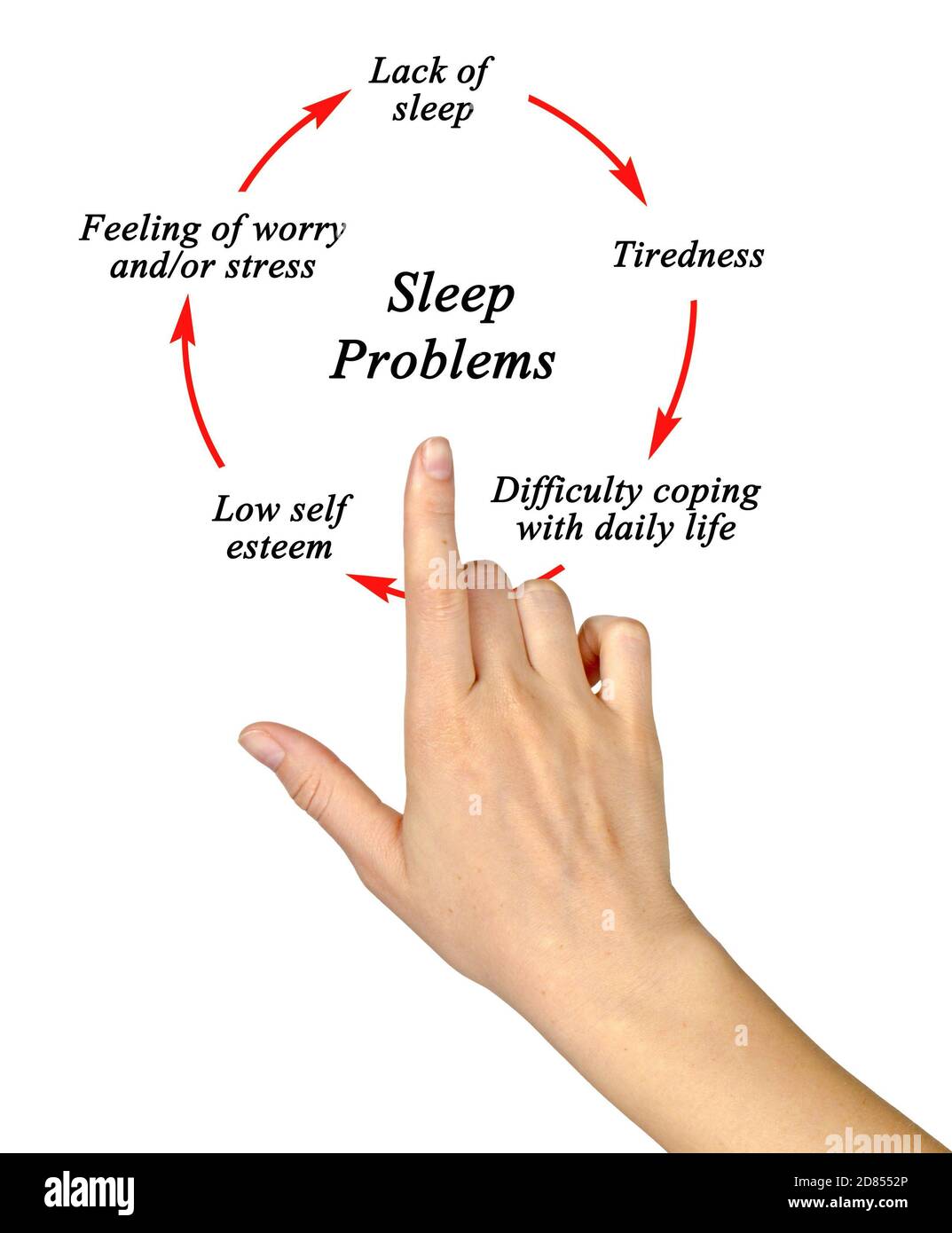 Steps in Cycle of Sleep Problems Stock Photo - Alamy