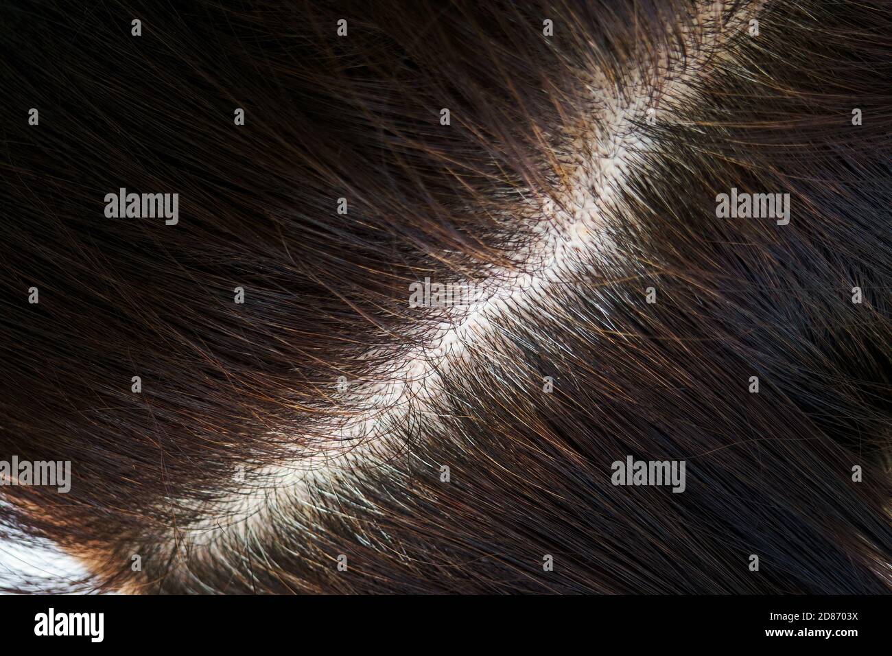Dark gray head hi-res stock photography and images - Alamy