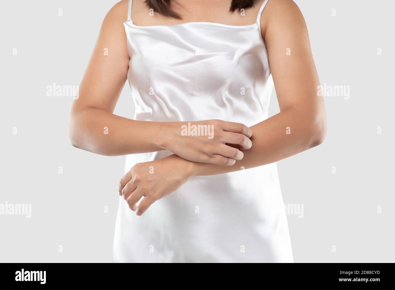 A woman in the white satin dress is scratching their arms due to ...