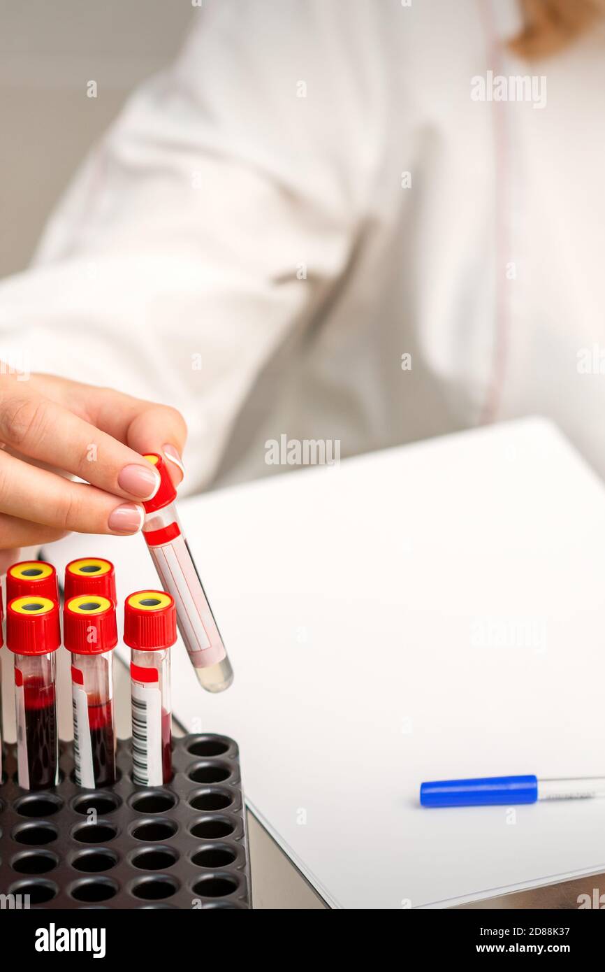 Analysing blood plasma lab hi-res stock photography and images - Alamy