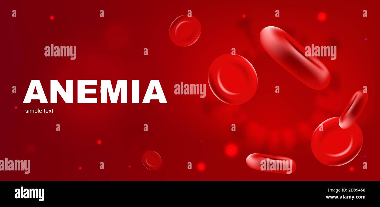 Anemia realistic vector banner template Stock Vector Image & Art - Alamy