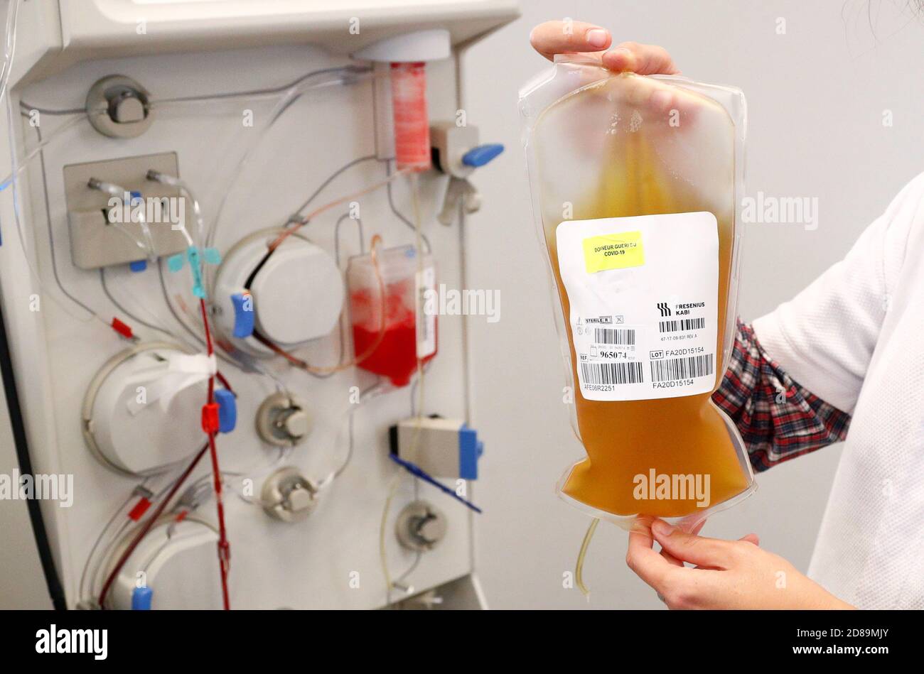 Plasmapheresis Machine