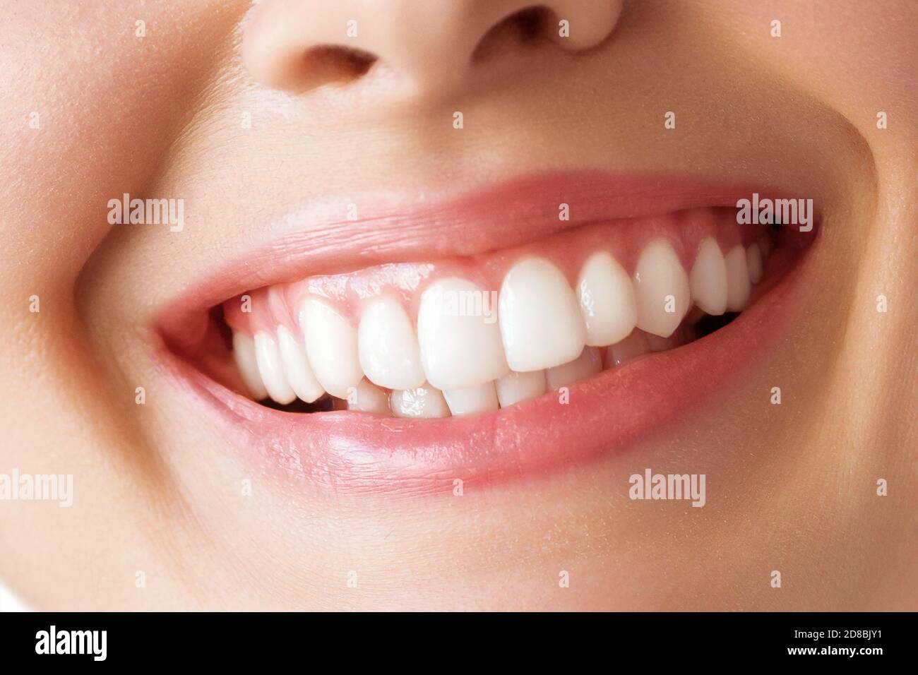 Perfect Healthy Teeth Smile Of A Young Woman Teeth Whitening Dental