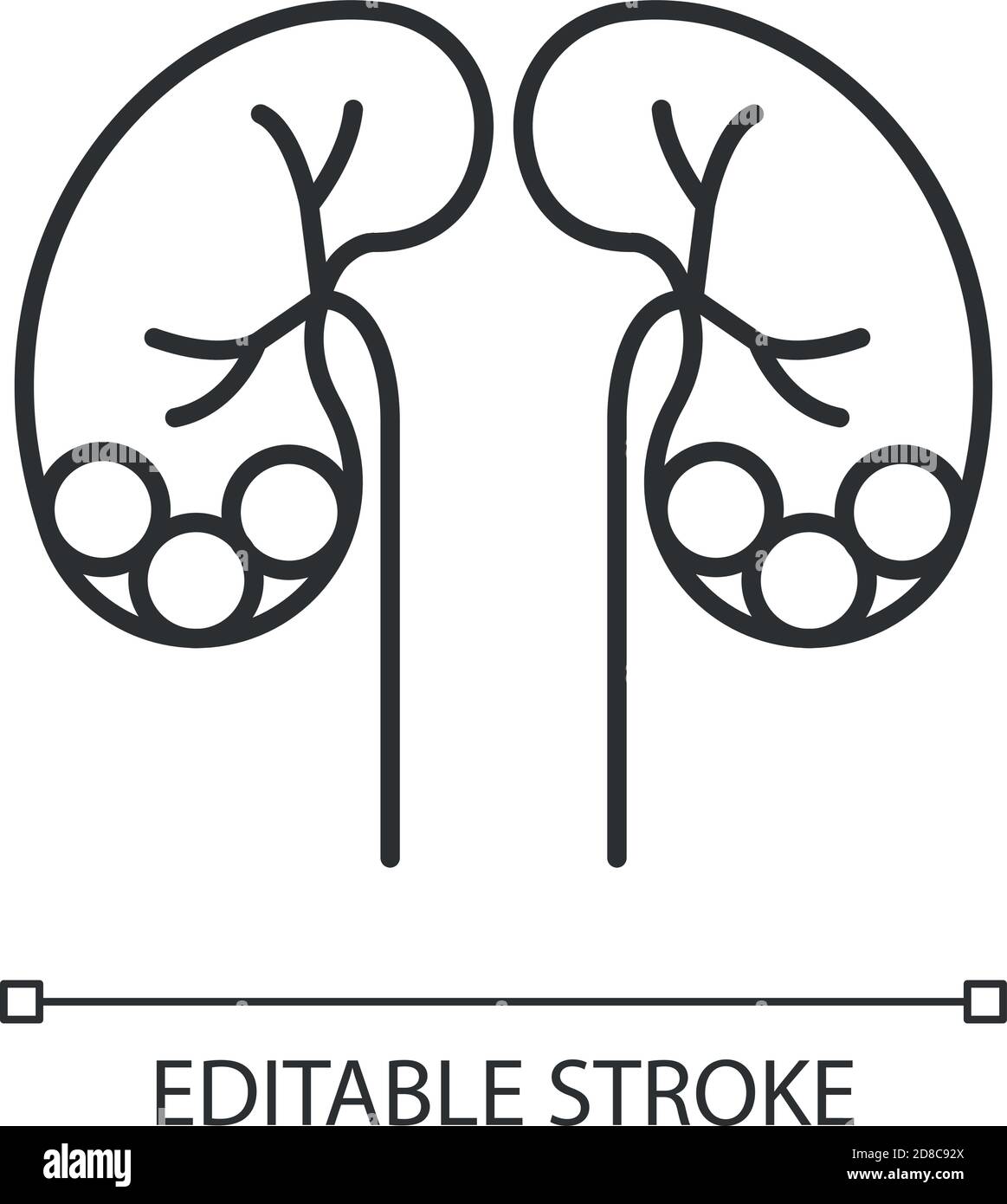 Urinary stone disease Stock Vector Images - Alamy