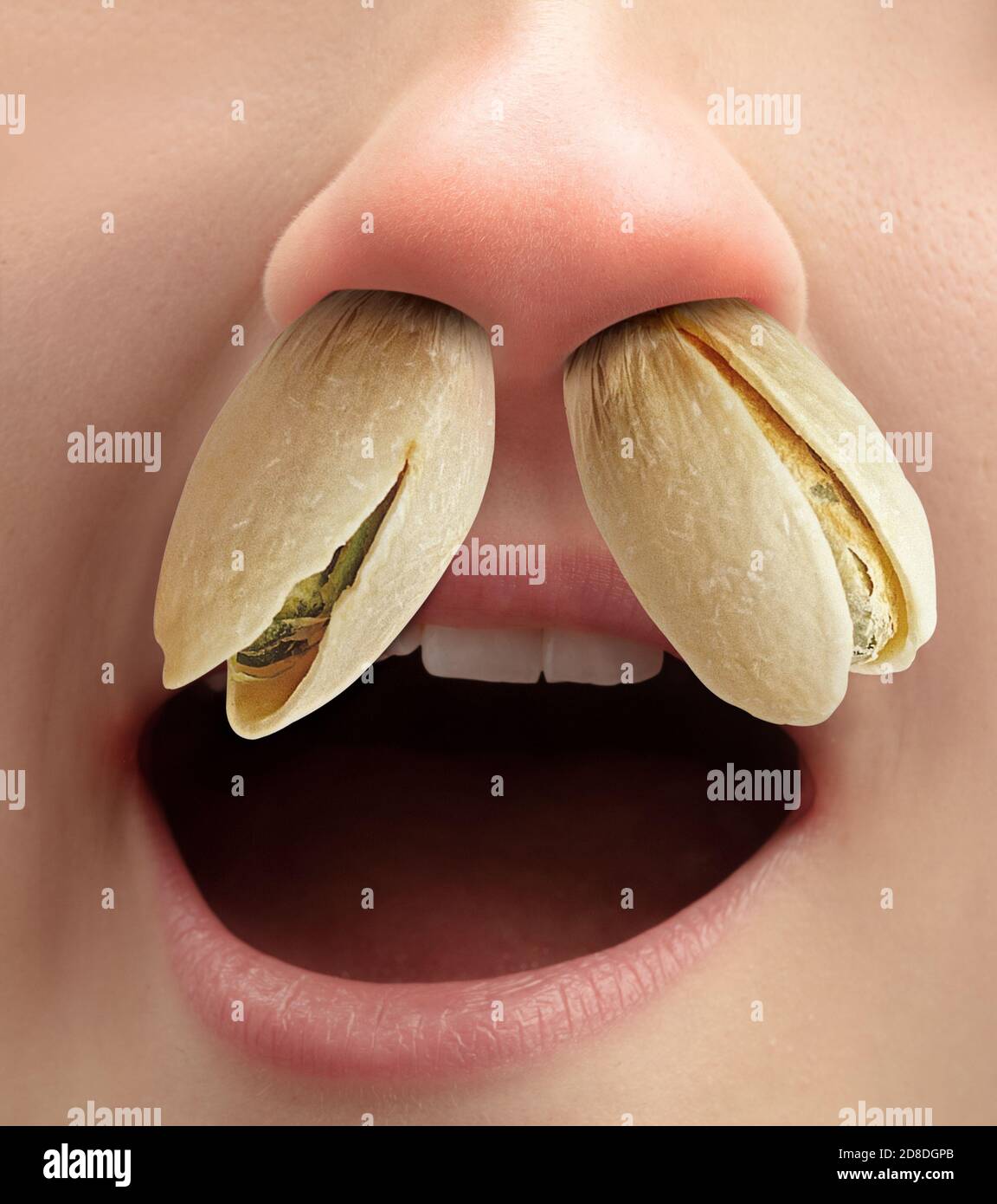 Nuts. Close up human nose with allergen causes a runny nose and ...