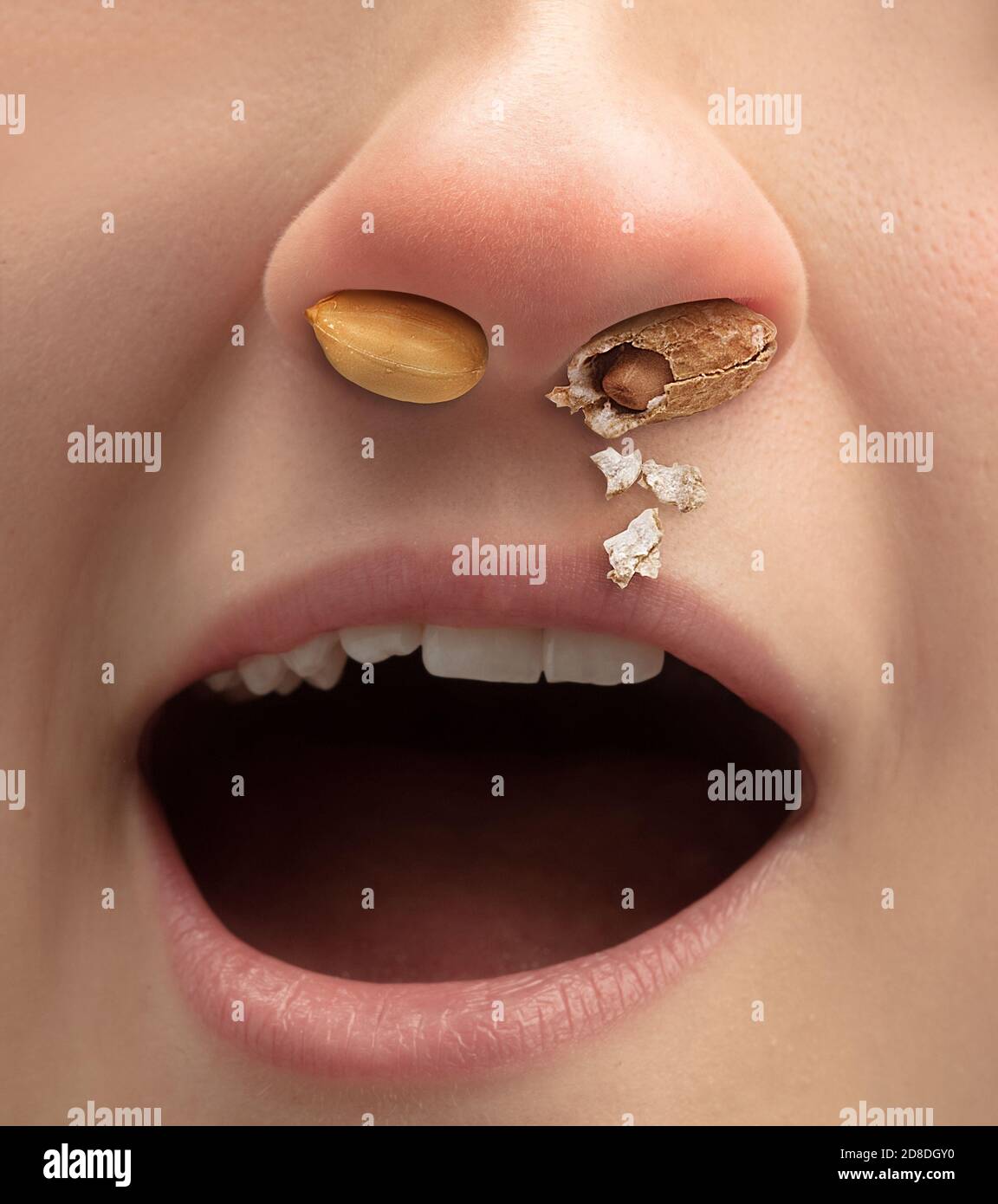 Causes a runny nose hi-res stock photography and images - Alamy