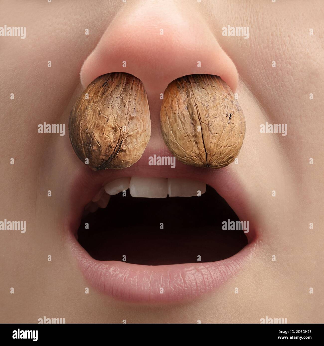 Nuts. Close up human nose with allergen causes a runny nose and ... Nuts. Close up human nose with allergen causes a runny nose and ...