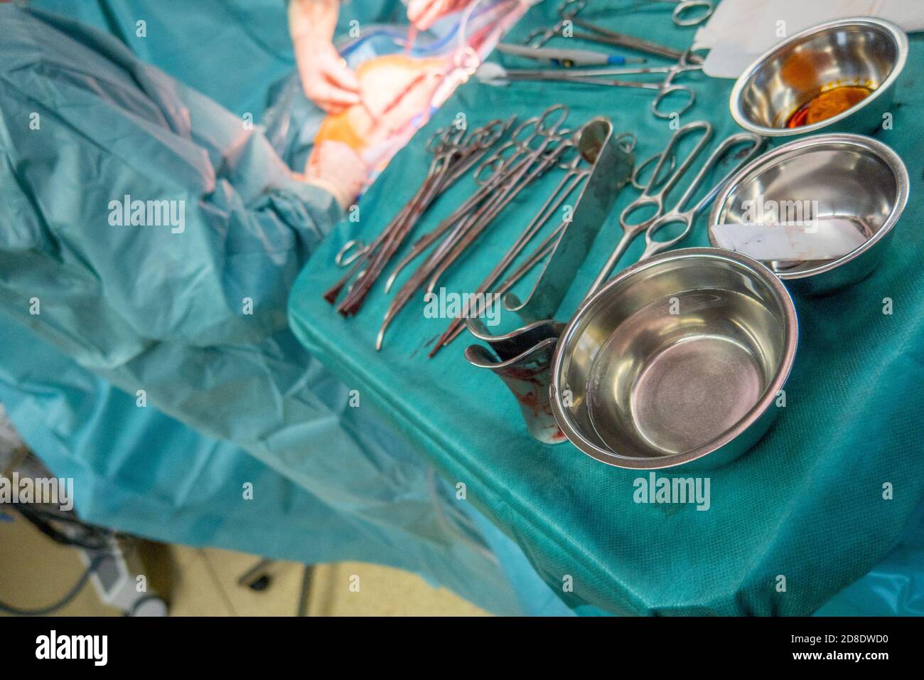 Various surgical instruments are placed on an operating table During an ...